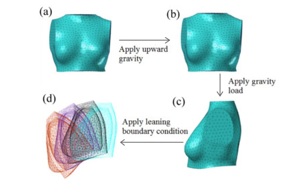 Optimization method for the determination of Mooney-Rivlin material coefficients of the human ...